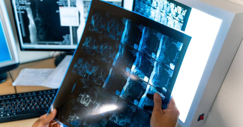 Raio X: o que é e como funciona na Radiografia