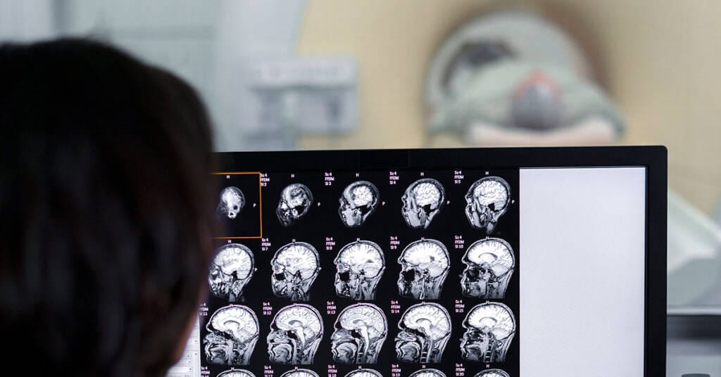 Ressonância Magnética: como funciona e quando é indicada?