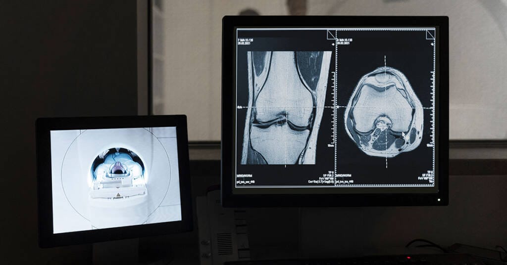 Sistema PACS: o que é e como funciona?