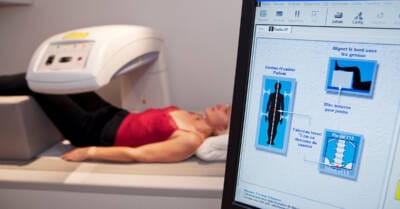Densitometria Óssea: o que é, indicações e como funciona