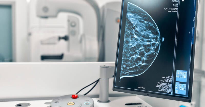 Classificação BI-RADS: o que é, como funciona e significados