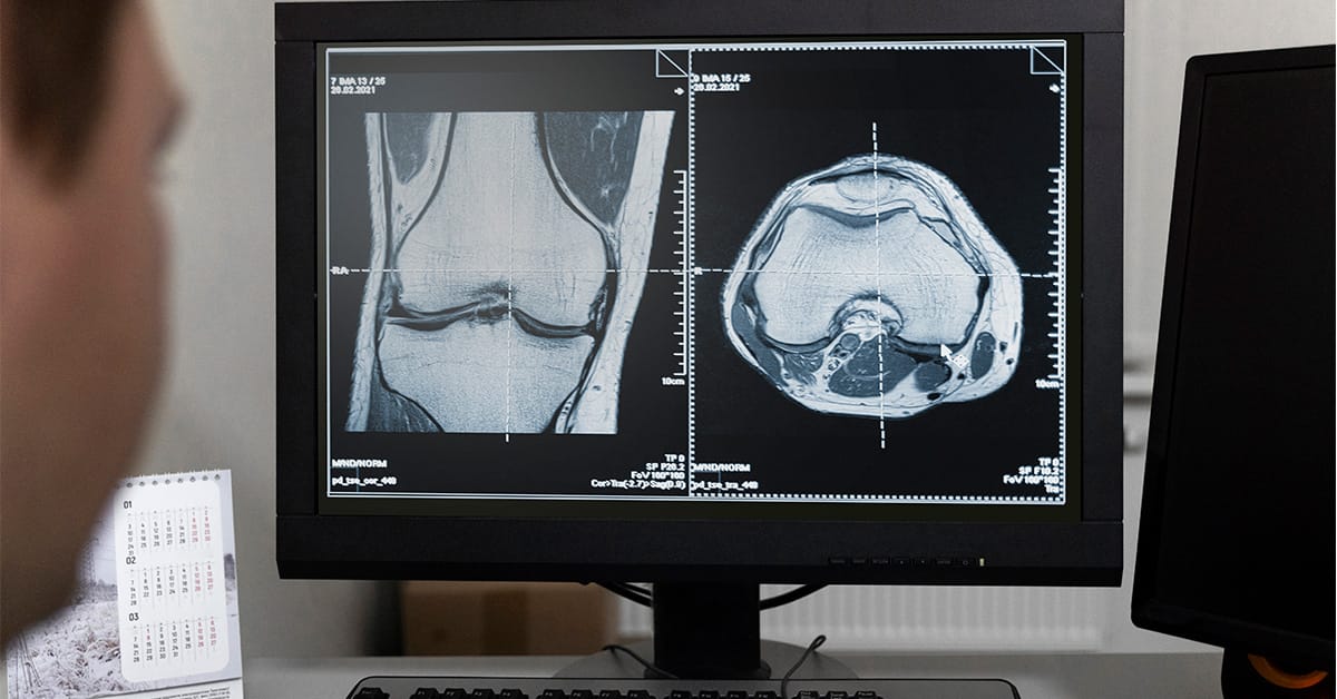 DICOM: o que é e como funciona na Radiologia